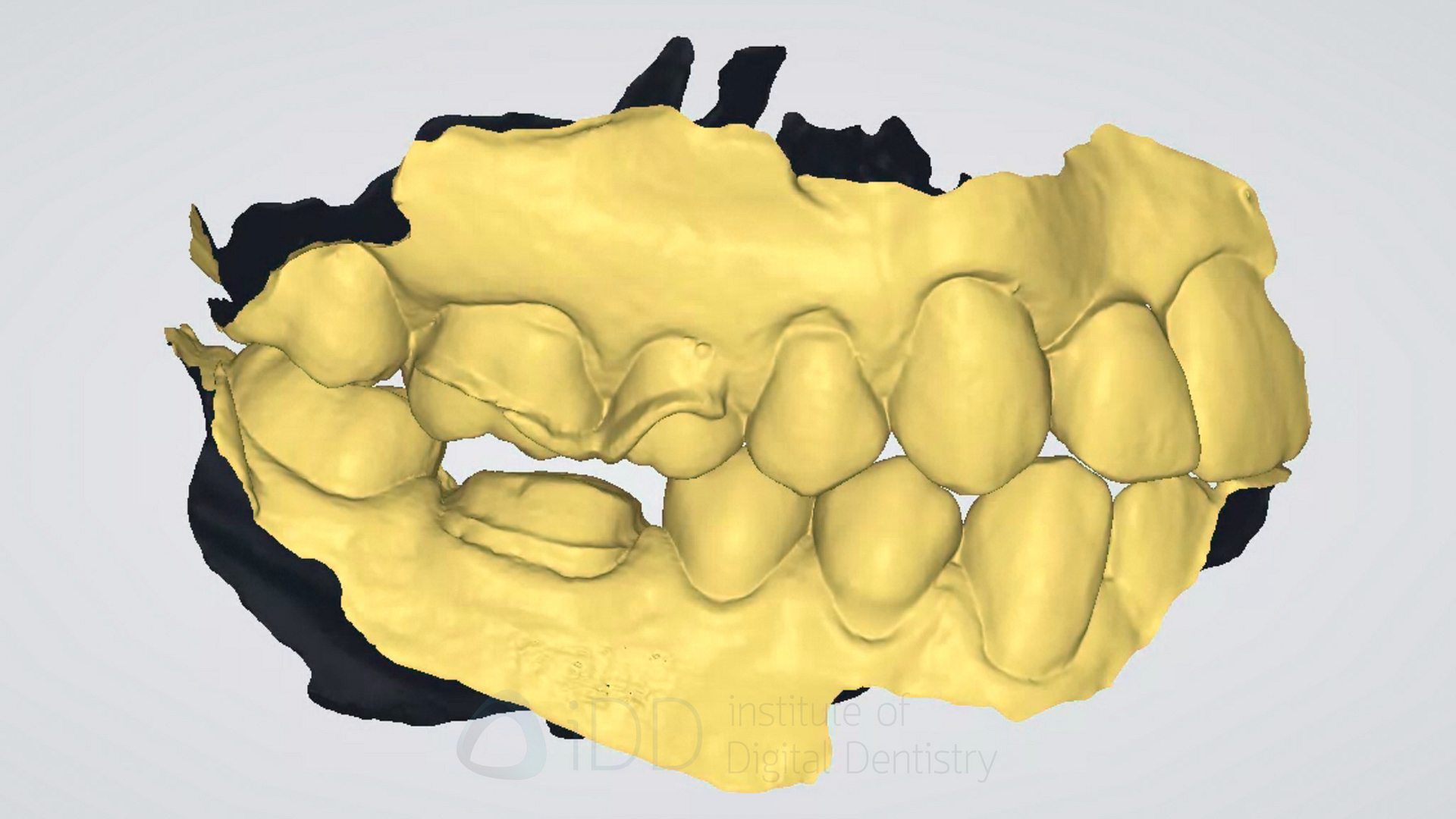 Panda SMART Intraoral Scanner Review by iDD